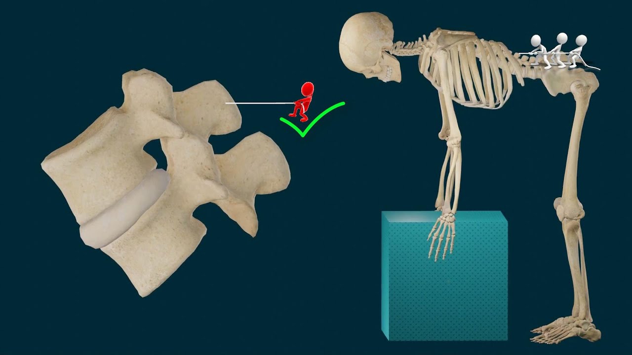 Spinal Erector Muscles