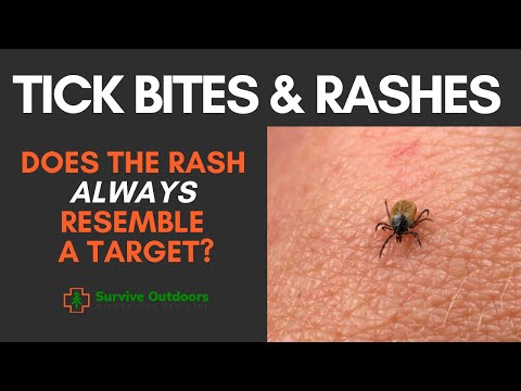 Two RASHES one TICK - How to Identify a Tick Rash