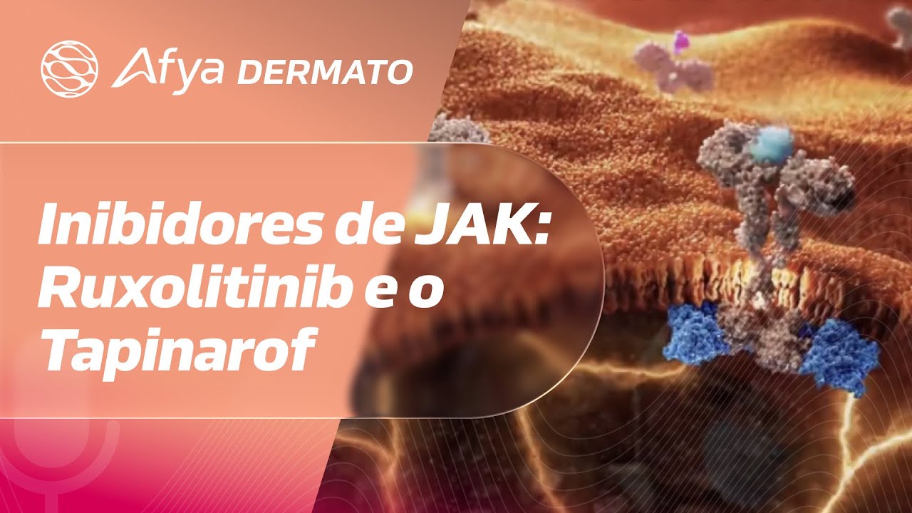 Inibidores de JAK: Ruxolitinib e o Tapinarof
