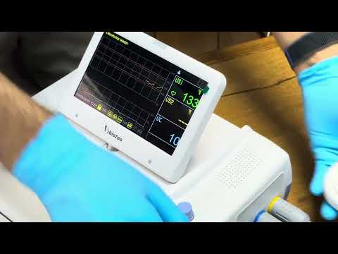 Fetal Monitor - Cardiotocography Machine Latest Price, Manufacturers ...