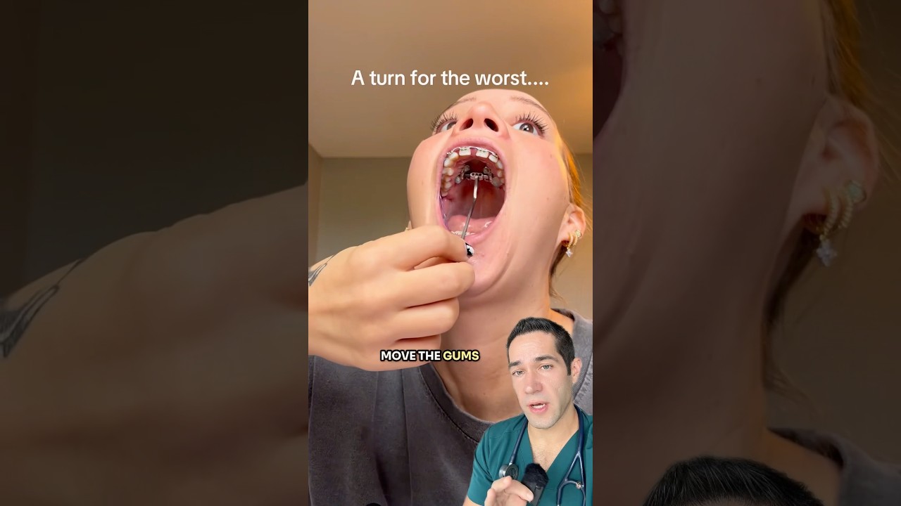 Why you do NOT want to open your mouth too wide