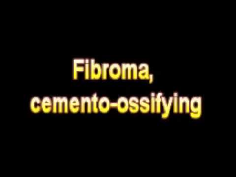 What Is The Definition Of Fibroma, cemento ossifying - Medical Dictionary Free Online