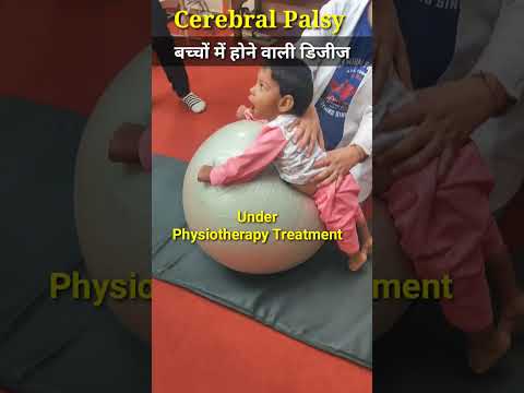 (सेरेब्रल पाल्सी) Cerebral Palsy #physiodrdeepaksoni #cerebralpalsy