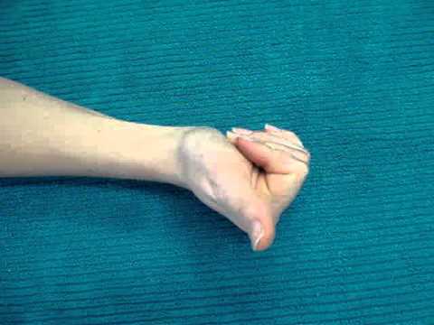 Tendon Glides