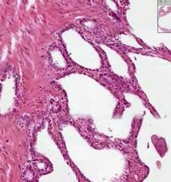Shotgun Histology Seminal Vesicles