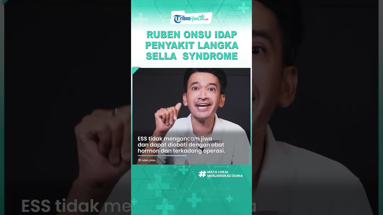 Ruben Onsu Idap Penyakit Langka Sella Syndrome, Buat Penglihatan Jadi ... Ruben Onsu Idap Penyakit Langka Sella Syndrome, Buat Penglihatan Jadi ...