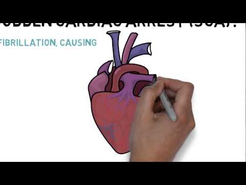 What is SCA?