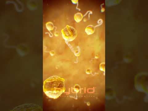 Dyslipidemia | lipoprotein A | LDL animation | cardiovascular disease | #lipoprotein #LDLparticles