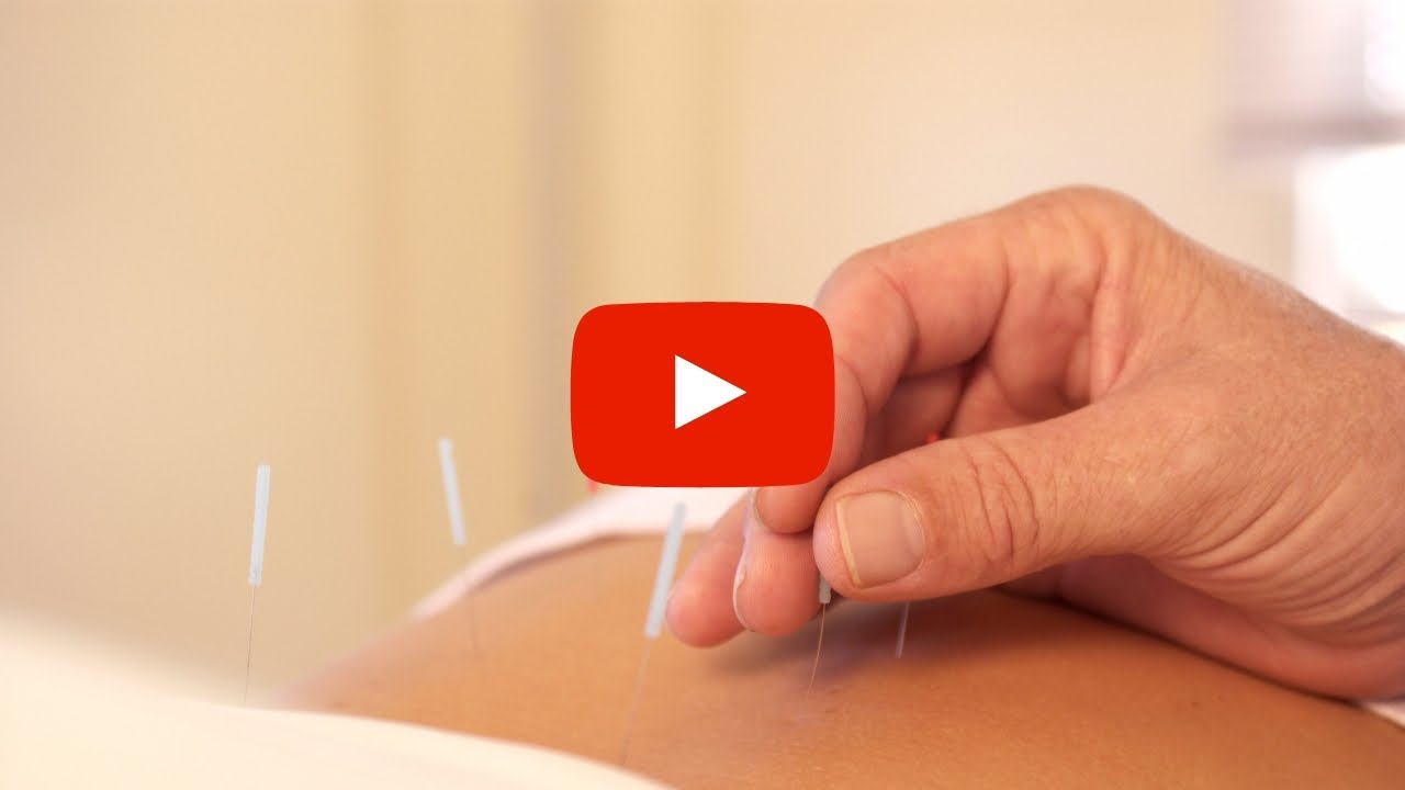 Acupuncture and the Correct Modifier