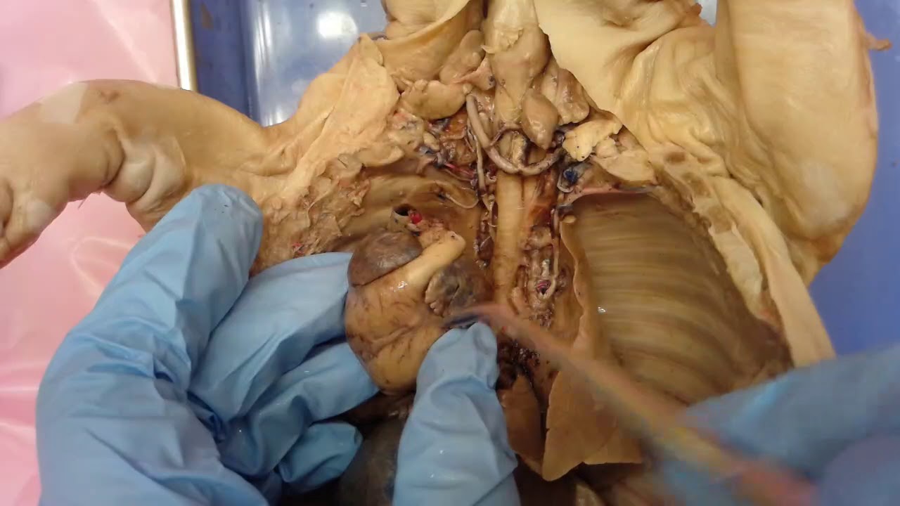 Fetal Pig Circulatory System