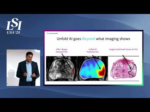 Shyam Natarajan, Avenda Health - AI-Driven Prostate Cancer Mapping Technology | LSI USA '25