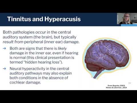 What is Hyperacusis?
