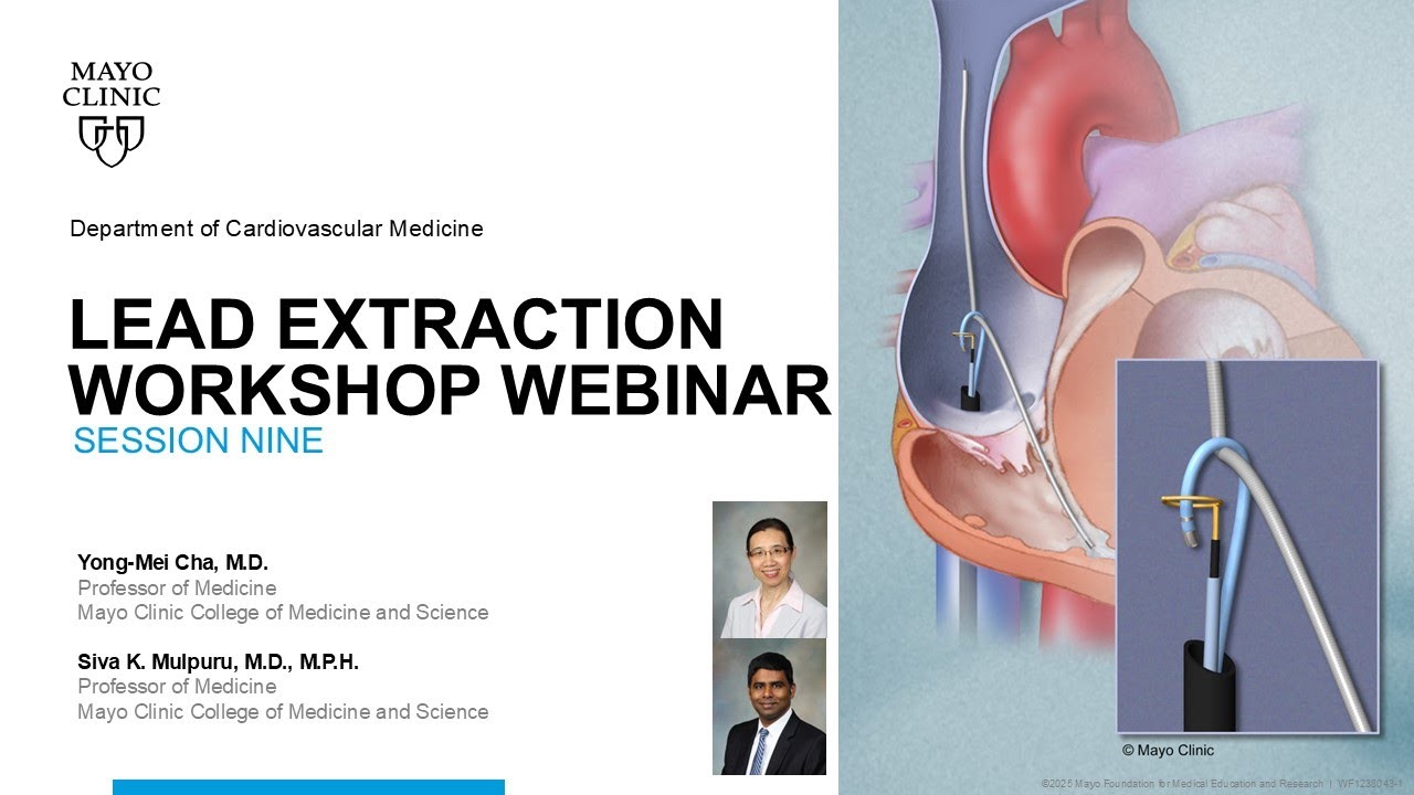 WEBINAR: Lead Extraction Workshop - Session Nine