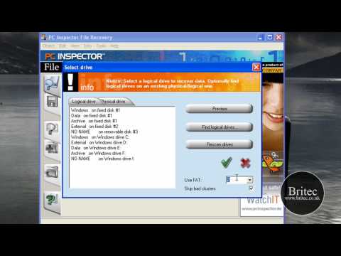 What Similarities And Differences Between Sleep, Amnesia And Coma. Part ...