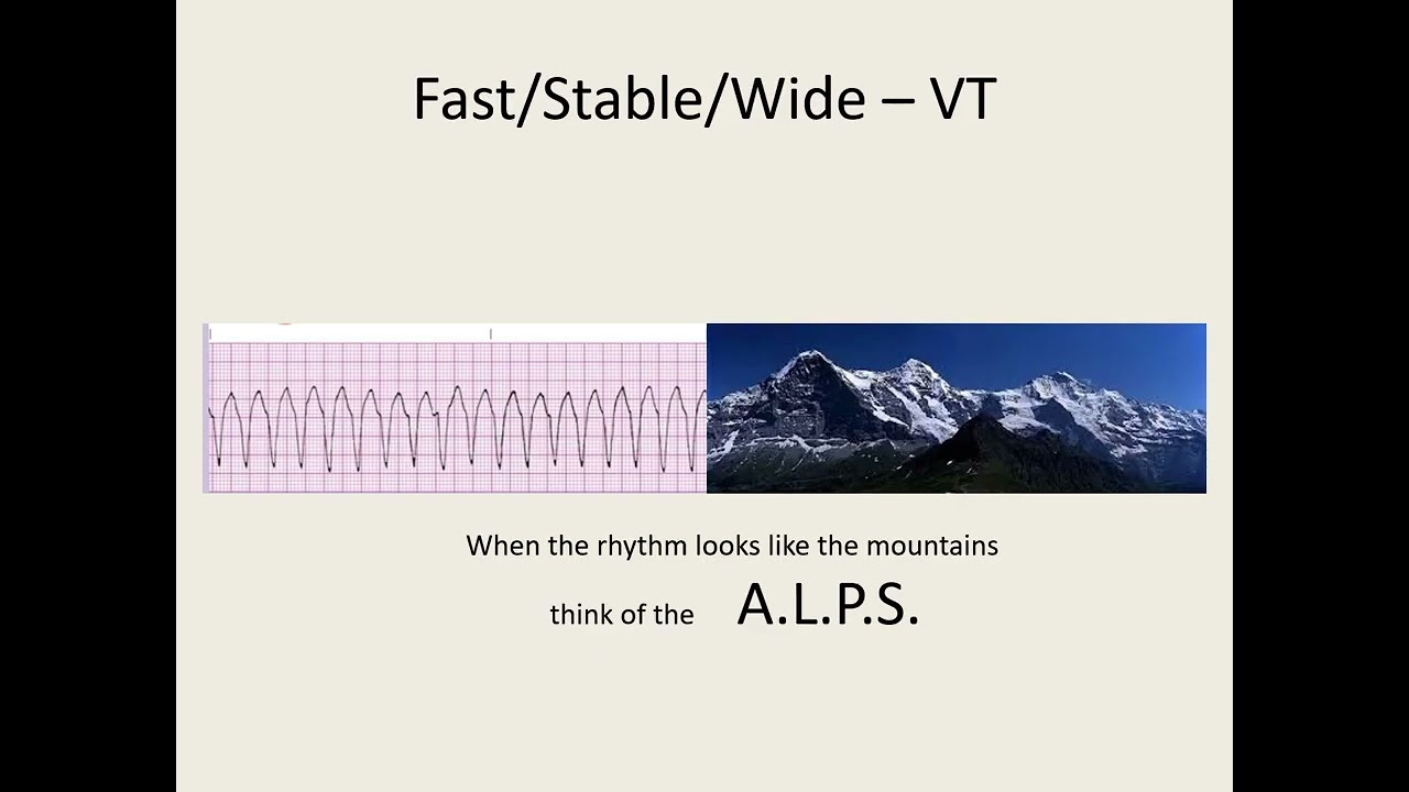 ACLS 2020 Algorithm Tachycardia