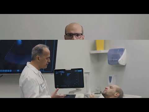 Ecocolordoppler Diagnostica Avanzata nel F-Medical Group Frosinone Risultati Immediati e Affidabili