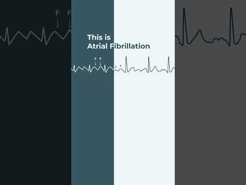 Atrial flutter or fibrillation? 🫀