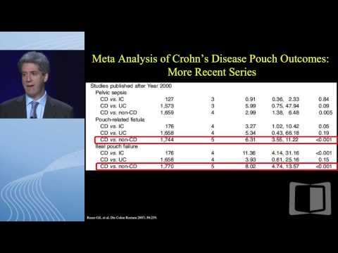Debate: Crohn's colitis patients can be offered an ileoanal pouch - Never
