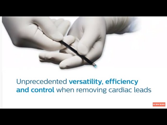 Cardiology - Lead extraction cardiology philips Spectranetics ...