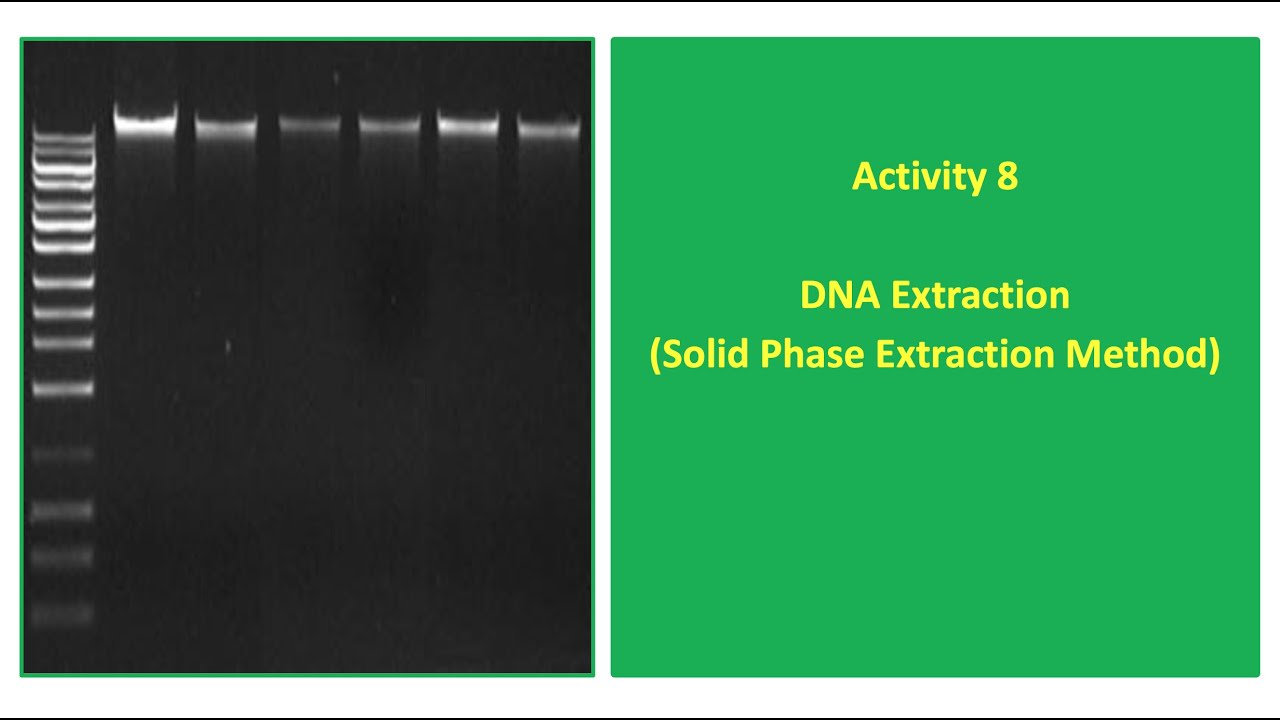 Activity 8. DNA Extraction (Solid Phase Extraction Method)