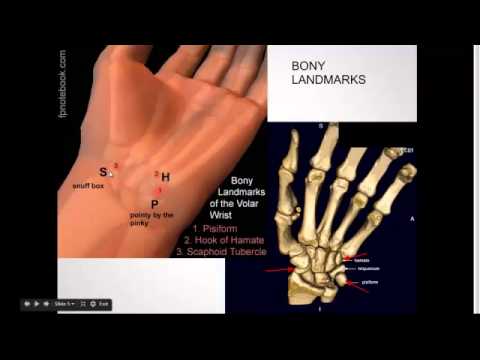 Carpal Bones / Fractures – EM in 5