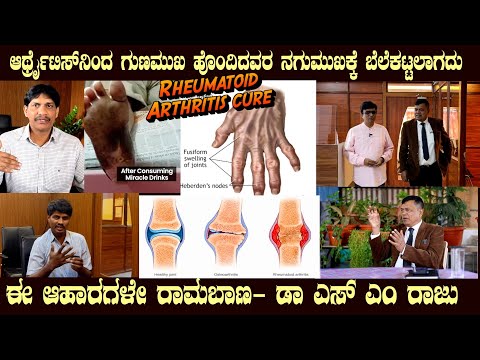 Rheumatoid ARTHRITIS Cured by Dr SM Raju IAS (Rtd) Soaked Ground nuts effectiveness explained