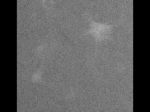 Motoneuronas (GCaMP6) + MCM-hSOD1G93A (Aplicación distal)