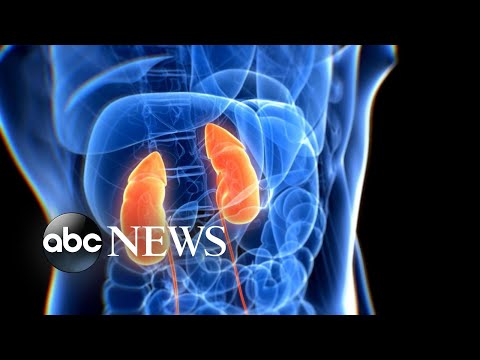 Doctors trying to understand COVID-19 symptoms left with more questions