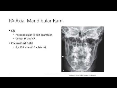 Radiographic Positioning of the Mandible
