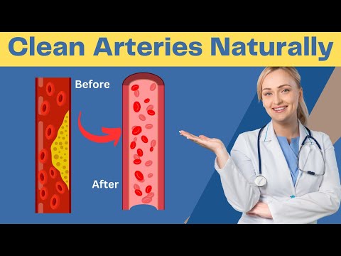 6 Foods to clean arteries | Prevent heart attack and stroke.