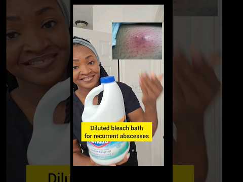 Doctor shares health hacks with home items. Never use concentrated bleach, or fragrance bleach.