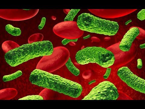What is Sepsis? Definition, Causes, Signs and Symptoms of Septic shock