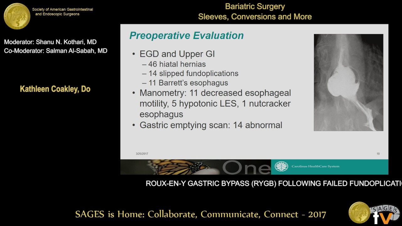 RYGB following failed fundoplication