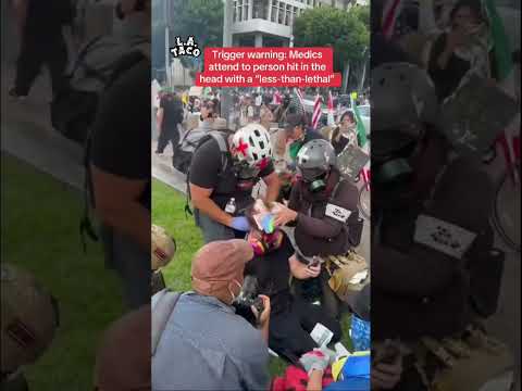 Medics treat peaceful protestor hit in the head with a “less-than-lethal” at No Kings Day in L.A.