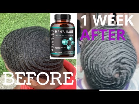 Hair Growth Vitamins For Men - Anti Hair Loss Pills. Regrow Hair & Beard Growth Supplement