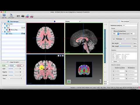 MI-Brain - Create a binary map from streamlines