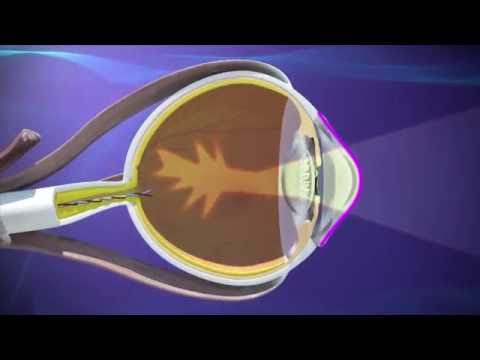 Cataract Surgery Options in New Jersey at Clifton Eye Care