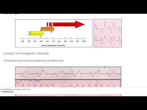 AKI – teaching – EMbeds.co.uk