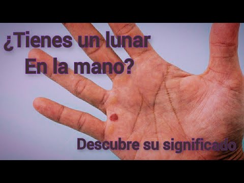 Lunares en la mano significado