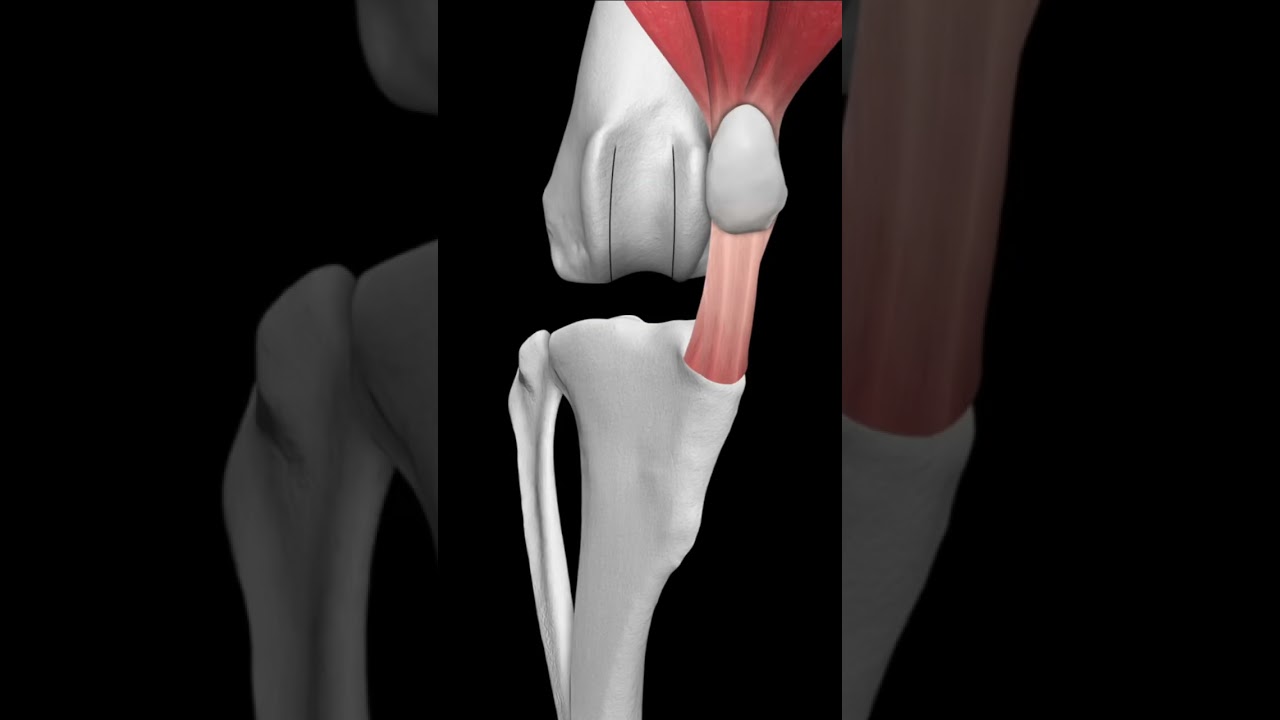 Standard patellar luxation surgery