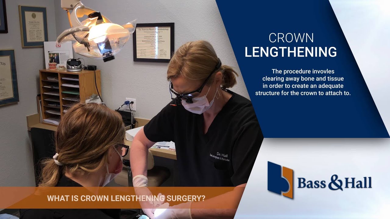 What is Crown Lengthening Surgery?