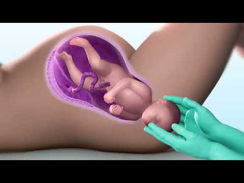 3D Medical Animation Child Birth Process Scientific Animations 720p, h264