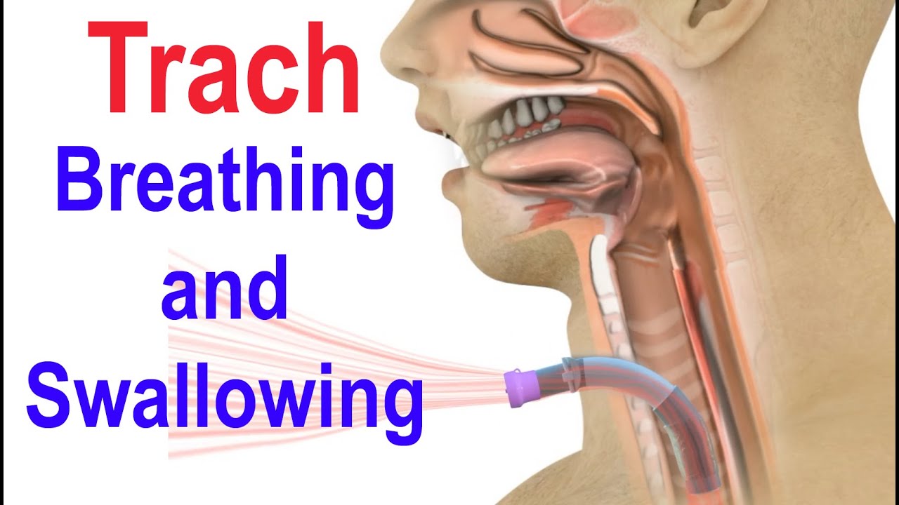 Trach Breathing and Swallowing