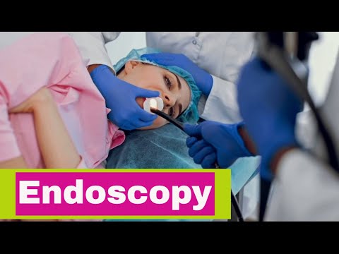Upper GI Endoscopy | How to Perform Gastroscopy