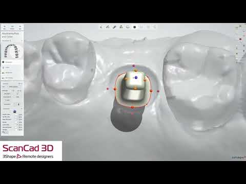 3shape 05-28-2025 N