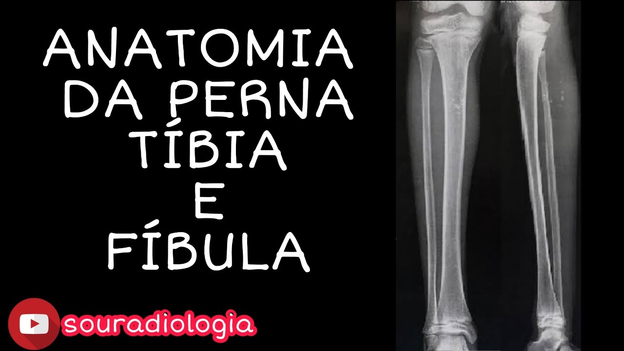 Anatomia dos ossos da perna:Tíbia e Fíbula (Radiologia)