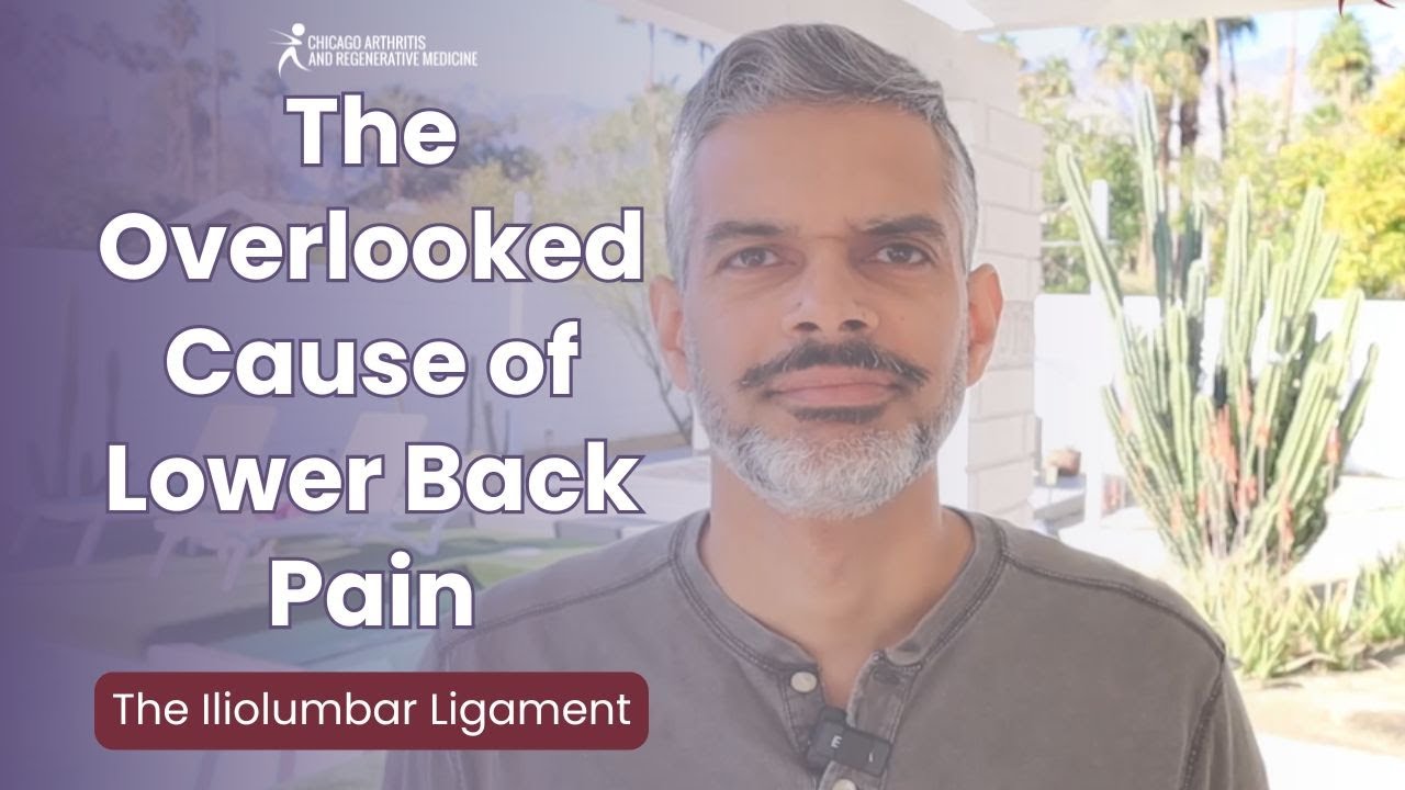 The Overlooked Cause of Lower Back Pain: The Iliolumbar Ligament ...