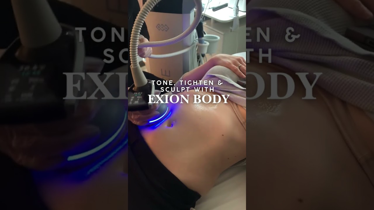 Exion Body