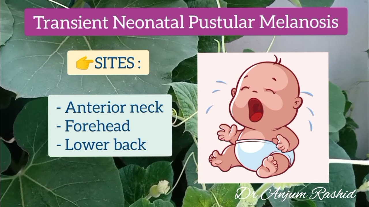 Newborn Baby Rash - Part 2 | Transient Neonatal Pustular Melanosis Cause, Symptoms, & Treatment