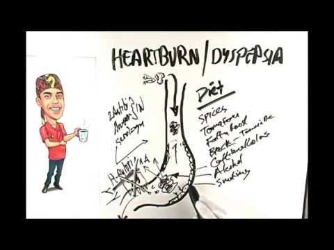 Heartburn Dyspepsia Explained Simply